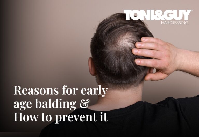 Reasons for Balding at a Young Age | Explained